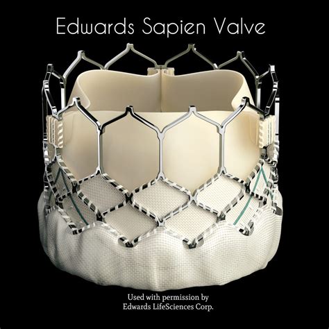 Tavr Valve Edwards At Julia Belcher Blog