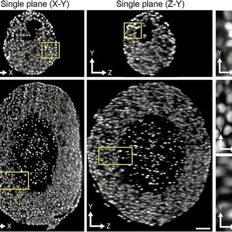image quality of three dimensional datasets three dimensional volume
