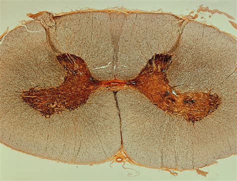 Real Spinal Cord Cross Section Spinal Cord Tissue Royalty Free Images