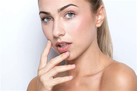 Bruising After Lip Filler What To Expect And How To Minimise Discomfort