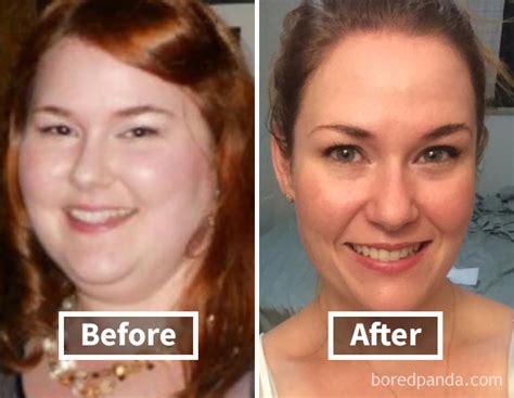 128 Surprising Photos Of Face Fat Loss Before And After Weight Loss