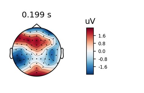 Eeg Processing With Python But In R Redux Matt Craddock