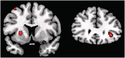 The Results Obtained For The Switch Vs Nonswitch Contrast P Download Scientific Diagram
