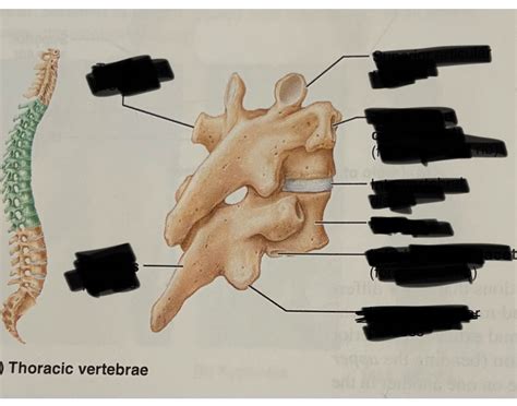 Thoracic Vertebrae Quiz 2 — Printable Worksheet
