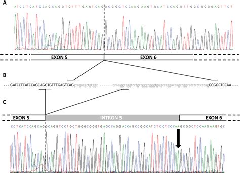 Sequencing Representation Of The Cdna Analysis A Chromatogram And Download Scientific