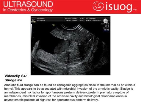 How To Measure Cervical Length Obstetric Ultrasound Ultrasound Cervical