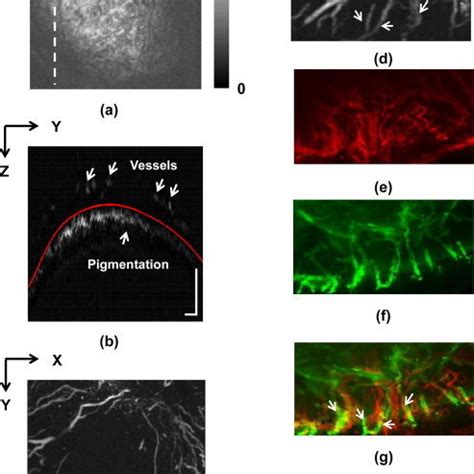 Diagram Of Corneal Structure And Corneal Neovascularization For A Download Scientific Diagram