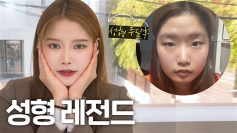 성형 잘된애들의 특징 Mlbpark