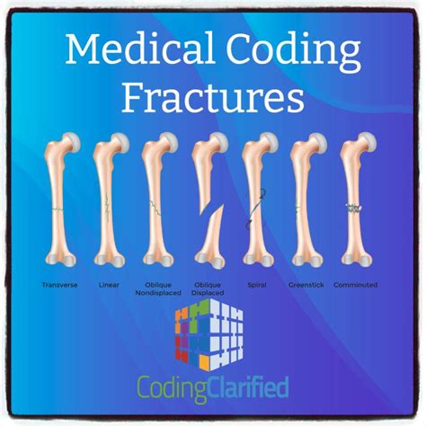 Lori Jaramillo Cpc On Linkedin Medical Coding Fractures