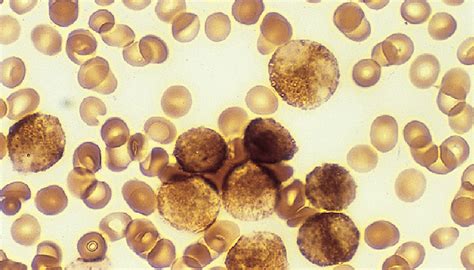 Myeloperoxidase Mpo Stain Purpose Principle Procedure And