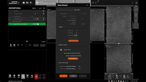 Mr Injector Coupling Via Imaging System Interface Isi 1 Siemens Healthineers