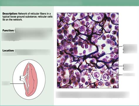 Reticular Fibers Lymph Node