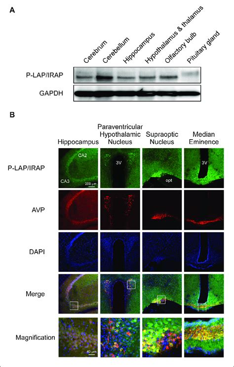 Expression Patterns Of P Lap Irap And Avp In Several Sub Regions Of Download Scientific