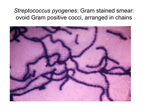 Staphylococcus Streptococcus Bacteriological Diagnosisi Ppt Infectious Diseases Diseases Staphylococcus Streptococcus Bacteriological Diagnosisi Ppt Infectious Diseases Diseases