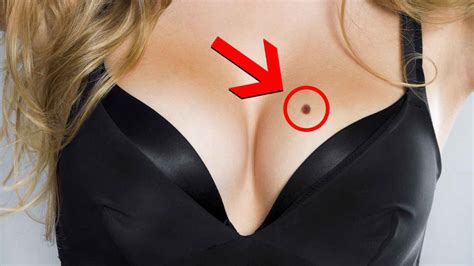 What Your Moles Mean And Say About Your Personality