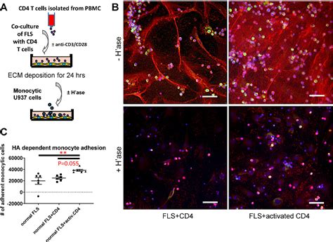 Figure 2 From Crosstalk Between Cd4 T Cells And Synovial Fibroblasts From Human Arthritic Joints
