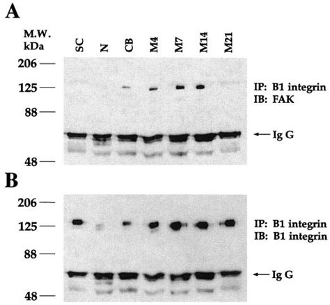 1 Integrin Antibody Coimmunoprecipitates Fak Two Hundred Micrograms Of