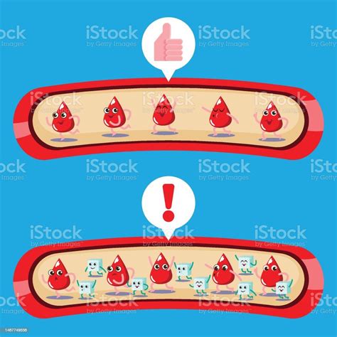 혈액 방울 캐릭터 만화 세트 컬렉션 귀엽고 행복하고 웃고 건강하고 건강에 해로운 죽상 동맥 경화증 혈액은 혈관을 통과 할 수 없습니다 벡터 현대 유행 플랫 스타일 만화입니다