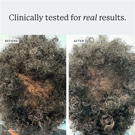 Densifying Scalp Serum