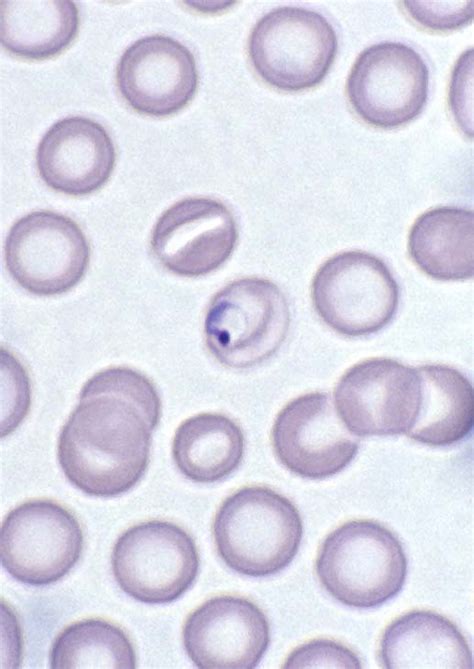 Apicomplexans Under Microscope