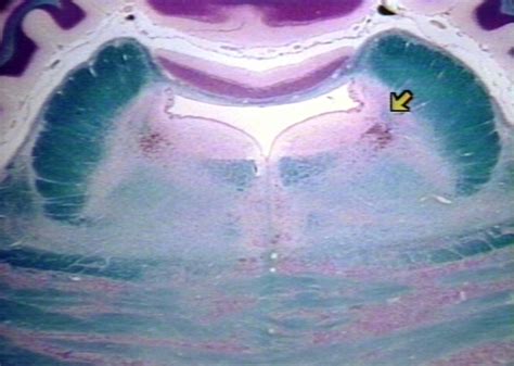 00201306 Peir Digital Library