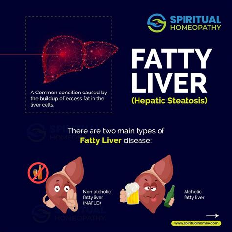 Improving Liver Health With Homeopathic Remedies