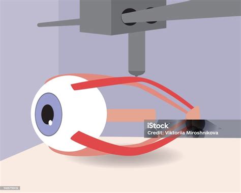 3d 프린터의 안구 기관 플랫 벡터 스톡 일러스트레이션 의학 및 건강 관리 기술의 개념 3차원 인쇄에 대한 스톡 벡터 아트 및 기타 이미지 3차원 인쇄 개념 건강
