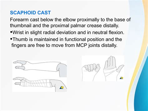 Scaphoid Fracture1pptxccccccccccccccc Pptx