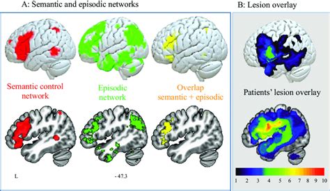 E Brain Networks Implicated In Semantic And Episodic Retrieval Overlap Download Scientific