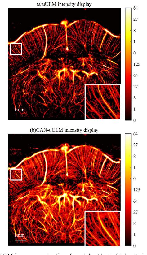 Figure 3 From Generative Adversarial Nets For Ultrafast Ultrasound Localization Microscopy