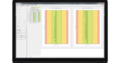 monthly qa standard imaging