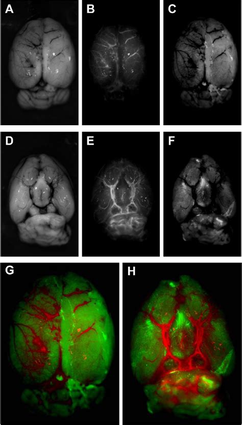 Figure 1 From Multispectral Molecular Imaging Of Capillary Endothelium To Facilitate