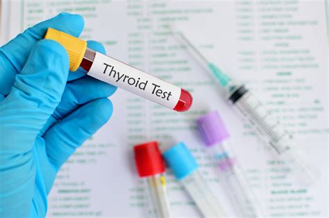 Thyroid Testing Dr Kela Smith