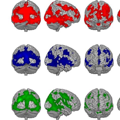 Neural Regions Exhibiting Significant Functional Connectivity With The Download Scientific
