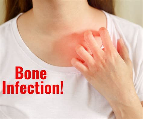 Bone Infection Brucato Foot And Ankle Surgery