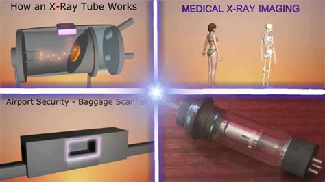 Xray Youtube