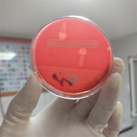 Streptococcus Camp Sareh Montazeri