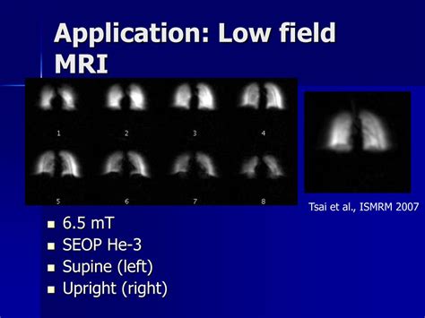 Ppt Hyperpolarized Mri Powerpoint Presentation Free Download Id 344631