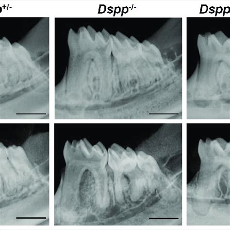 Dentin Sialophosphoprotein Dspp Is Reduced In Dmp 1 Null Mice To Download Scientific Diagram