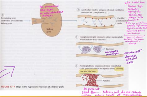 Lecture 12 Flashcards Quizlet