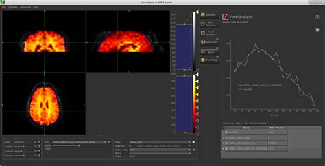 Qbold Tutorial — Quantiphyse Documentation