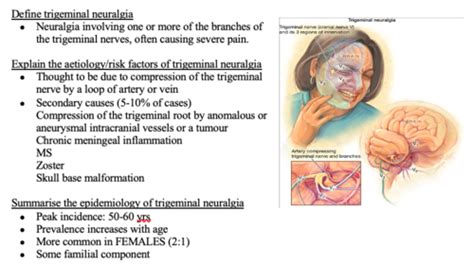 Neurology Trigeminal Neuralgia Flashcards Quizlet