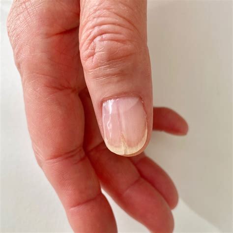 爪白く する 爪 白い部分 多い Ynvhu
