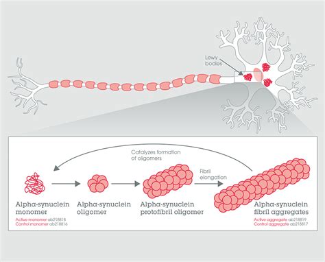 Protein Aggregates Neuron At Jacob Shadforth Blog
