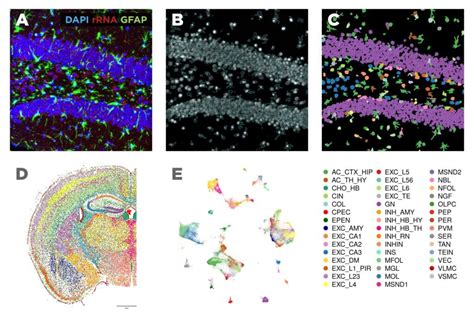 Cosmx Smi Mouse Brain Ffpe Dataset Nanostring