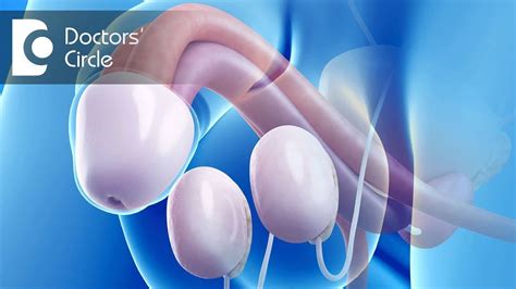 Баланопостит как выглядит реальные фото