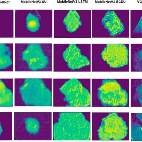 class activation mapping cam of the last convolutional layers