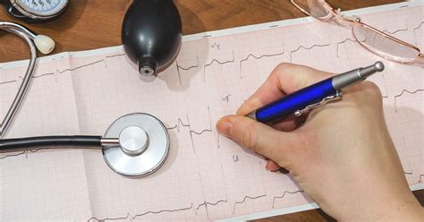 Trigeminy Pvc Definition Causes Treatment