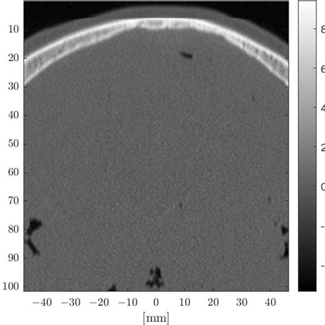 Cranial Section Of The Ct Image A And Corresponding Segmentation Into Download Scientific
