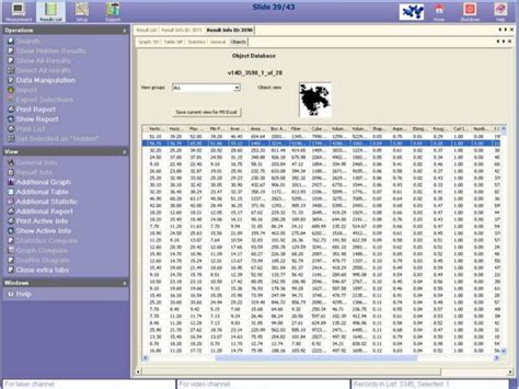 Dipa 2000 Particle Size And Shape Analyzer Ppsx Photo Editing Software Computer Software And